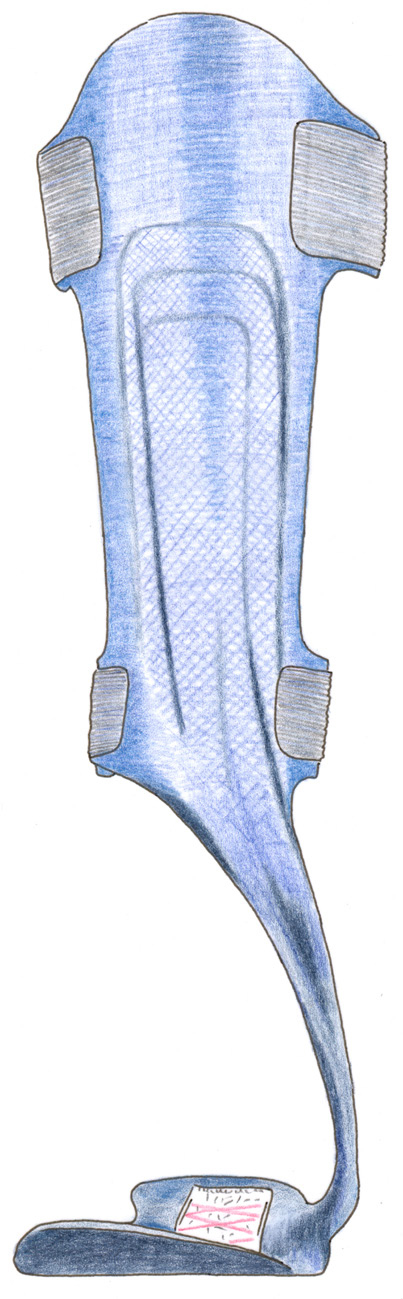 Orthonova | Ihmisten avuksi