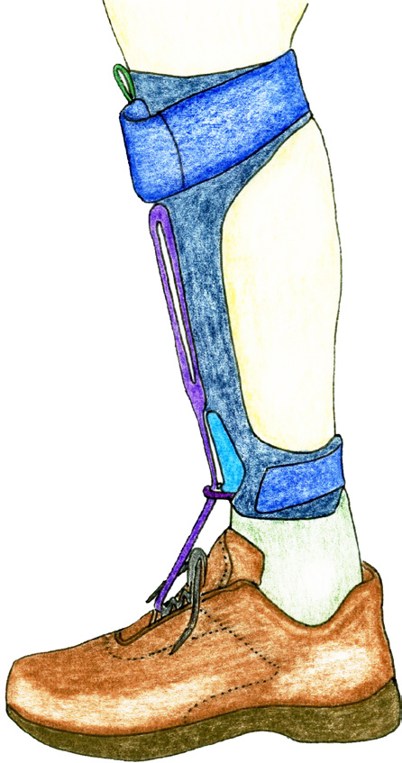 Orthonova | To help people