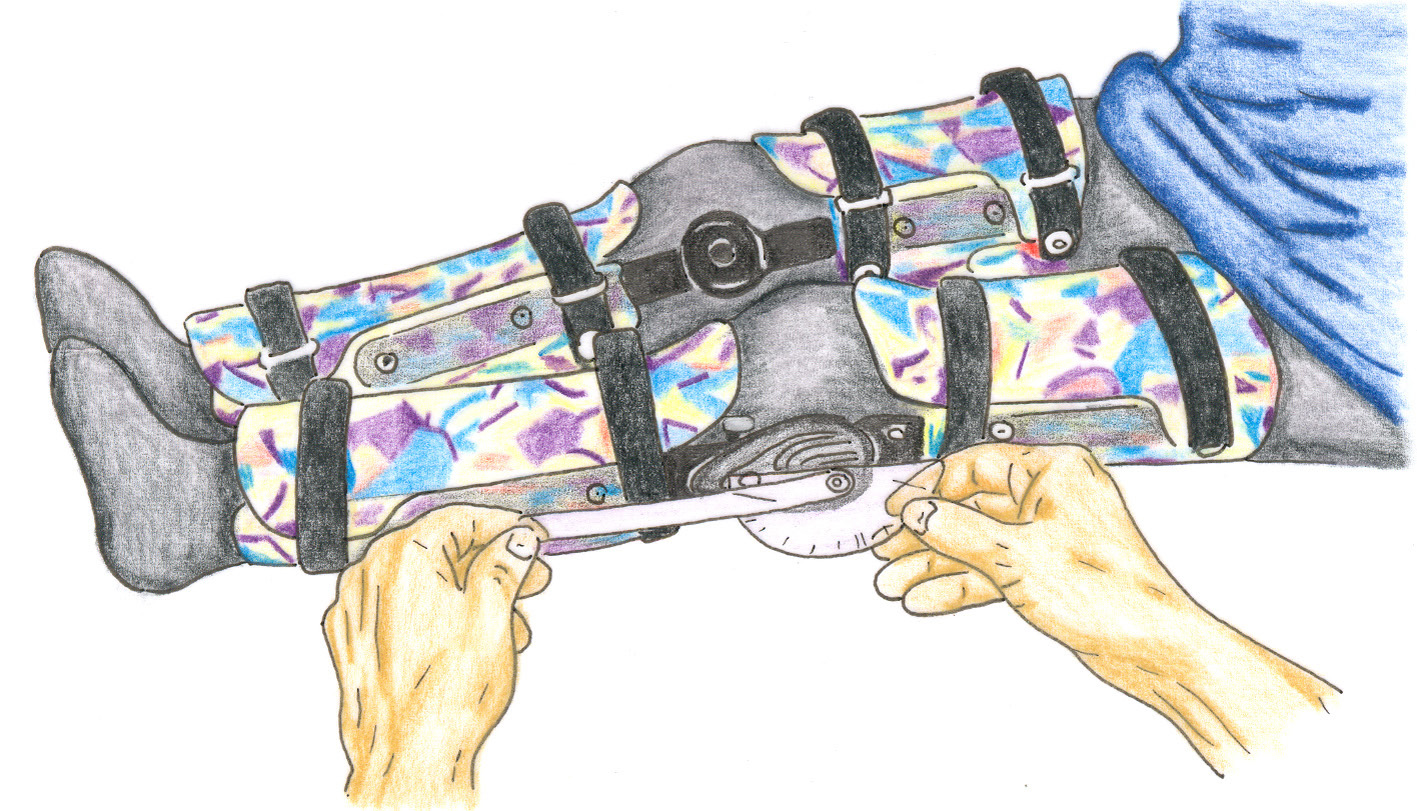 Orthonova | To help people