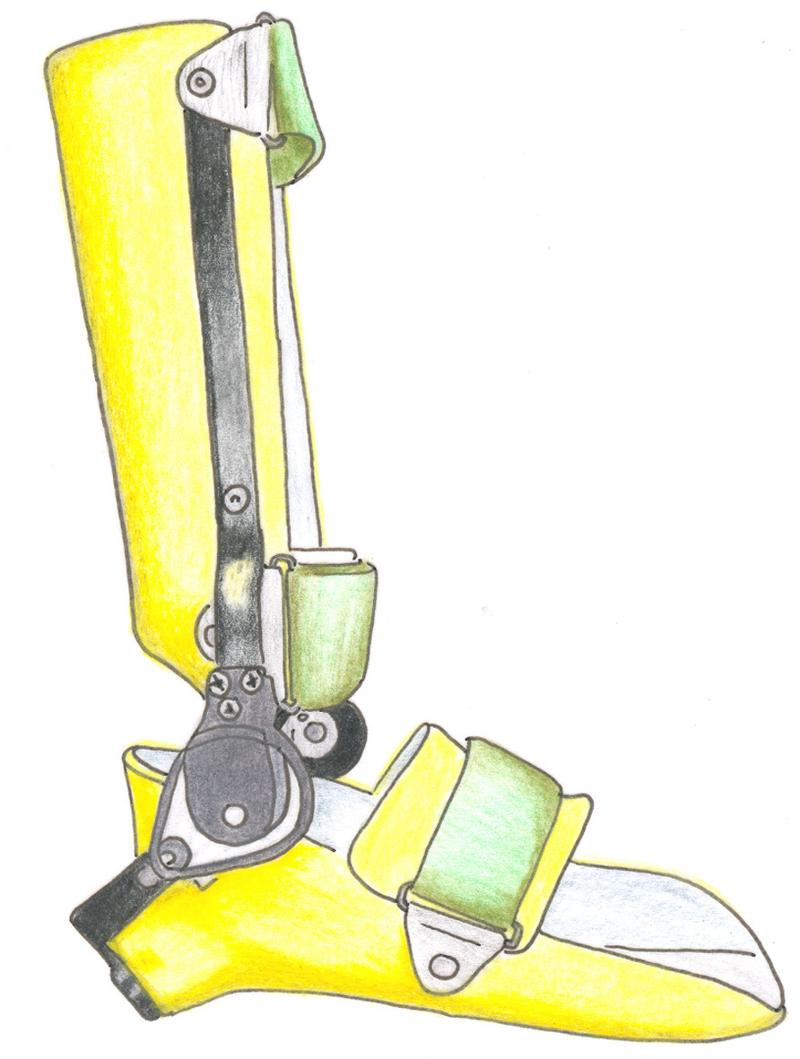 Orthonova | To help people